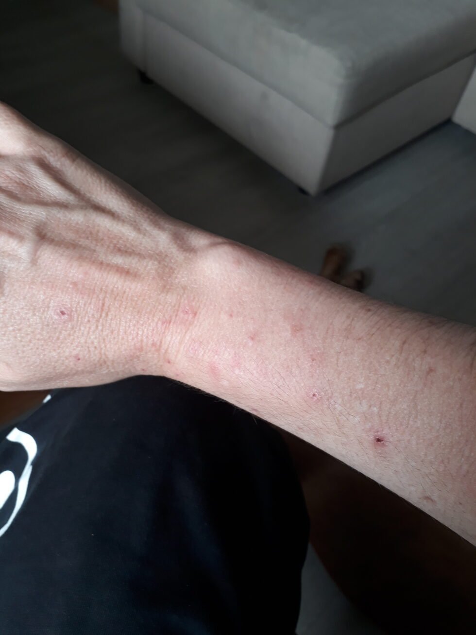 Traitement punaise de lit : Tout sur les Punaises de Lit - Blog ...